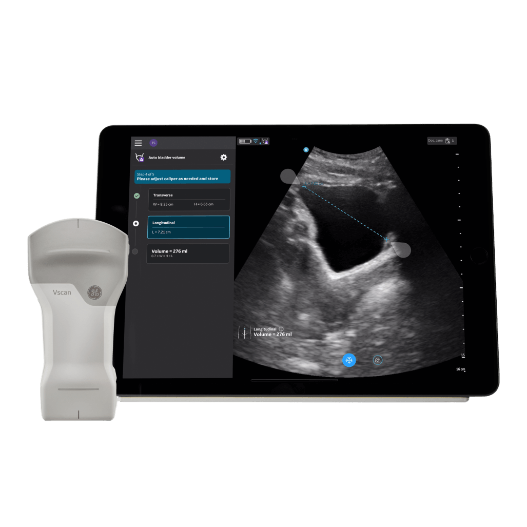 Shop Vscan Air™ CL Handheld Ultrasound | GE HealthCare